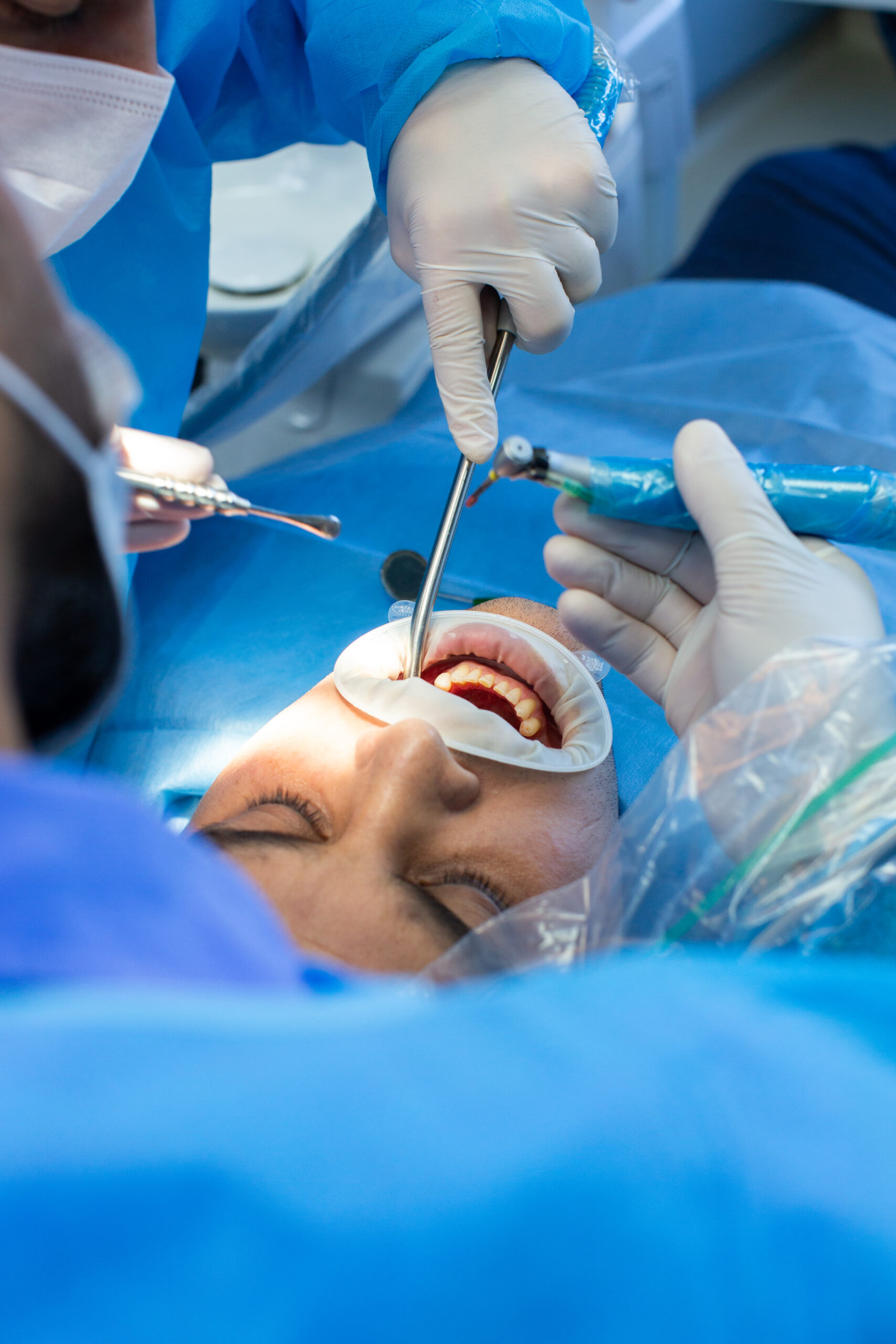 Surgery Dentistry – Via International